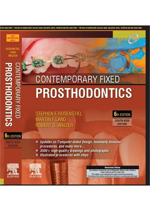 Contemporary Fixed Prosthodontics
